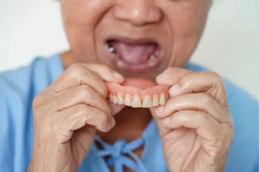 Denture Solutions for Bone Loss: When Implants + Dentures Make Sense